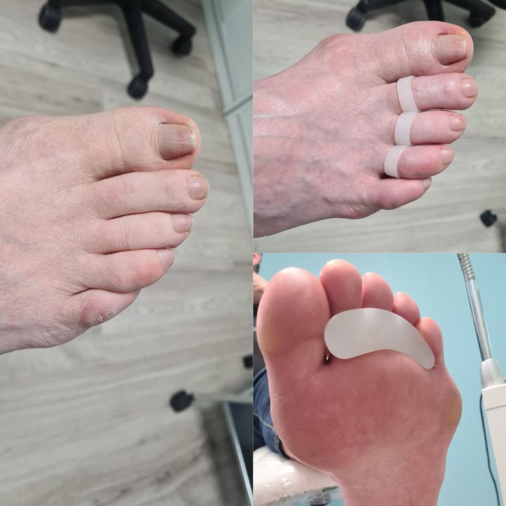 Miks on inimesel varbaid vaja? - Jalaravikabinet